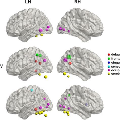 Costs Modularity And Robustness Of Brain Functional Networks Across