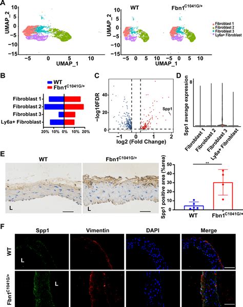 Spp1 Expressing Fibroblasts Increased In Mfs Aortic Aneurysm Download Scientific Diagram