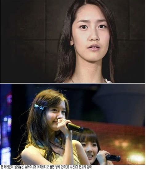 소녀시대 윤아 성형 전후 윤아 턱수술 성형설