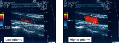 Doppler Physics And Instrumentation Flashcards Quizlet