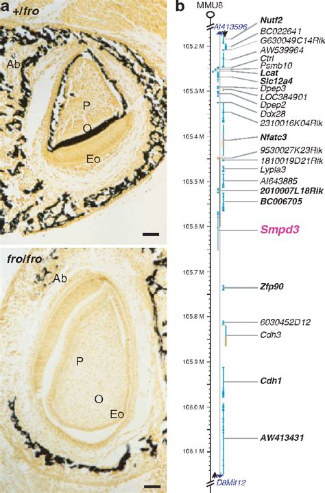 Smpd3 Gene Semantic Scholar