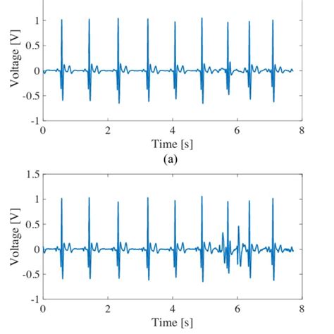 A Motion Artifact Removal Using Our Algorithm B Motion Artifact Download Scientific Diagram