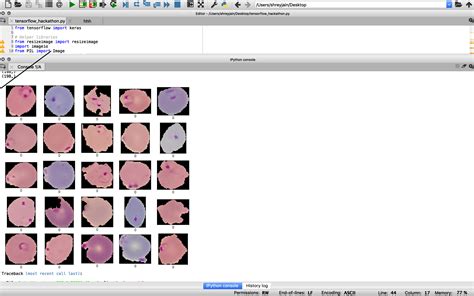 Malaria Cell Detection Devpost