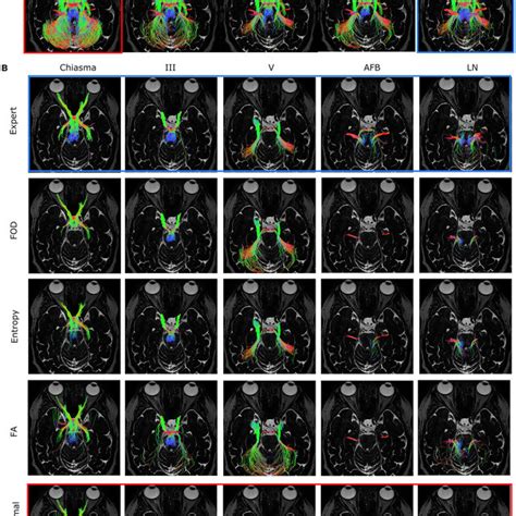 A Optimal Filtering Obtained For The Three Different Filtering Download Scientific Diagram