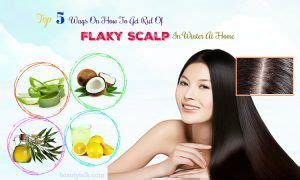 Top 5 Ways On How To Get Rid Of Flaky Scalp In Winter At Home