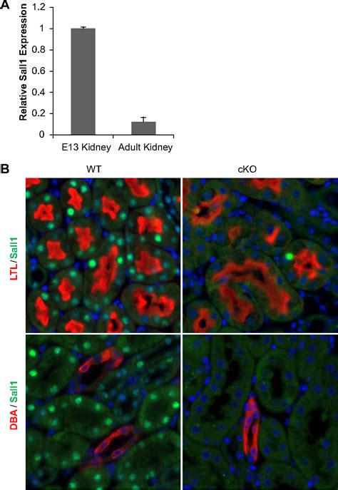 Figure 2 From A Mouse Model Of Townes Brocks Syndrome Expressing A