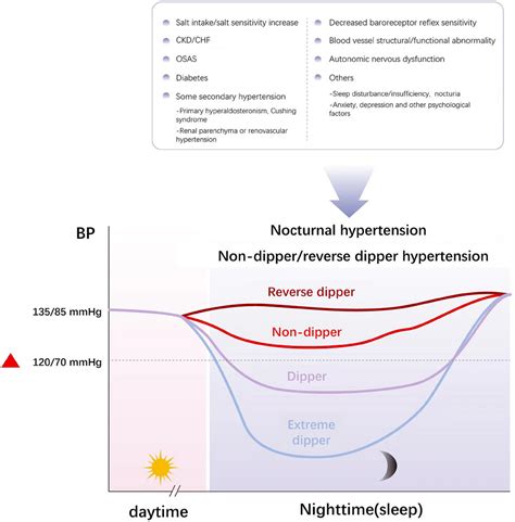 Management Of Nocturnal Hypertension An Expert Consensus Document From