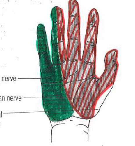 Lecture 4 Hand Conditions And Appropriate Assessments Flashcards Quizlet