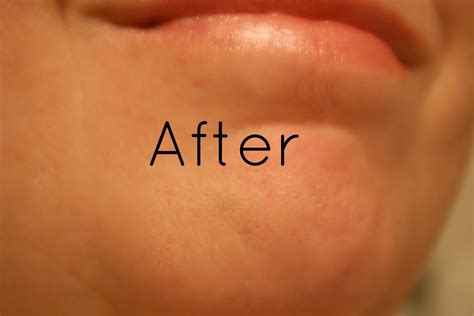 Elle Sees Beauty Blogger In Atlanta How To Hide A Pimple Using Drugstore Products