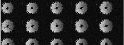 University Of Minnesota Developing Compact And Portable Mri Scanner Medical School