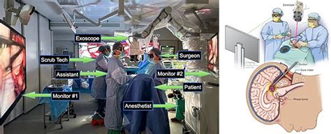 Exoscope University Of Pittsburgh