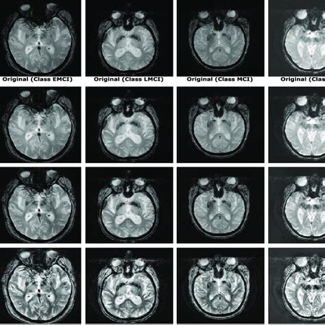 After Applying Image Enhancement Techniques Final Output Of The