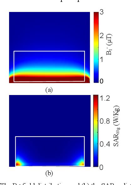 A Design Approach Of Surface Coil Element And Multi Channel Array To