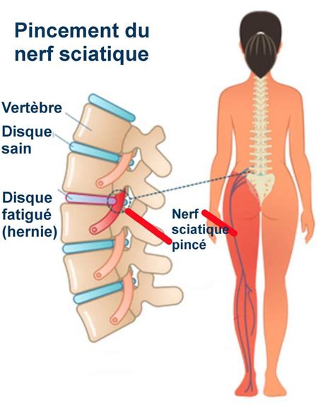 Comment Prévenir Le Mal De Dos Au Fauteuil Blog Des Fauteuils Sur