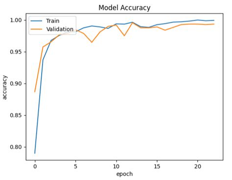 Github Farisjamaan Tuberculosis Detection A Deep Learning Model For Detecting Tuberculosis