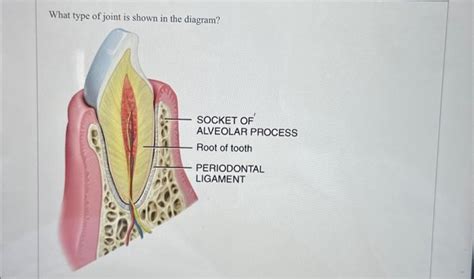 Solved What Type Of Joint Is Shown In The Diagram Socket Of