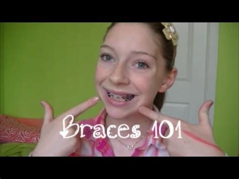 Braces Youtube