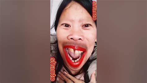 অনেক সুন্দর দাঁত Youtube