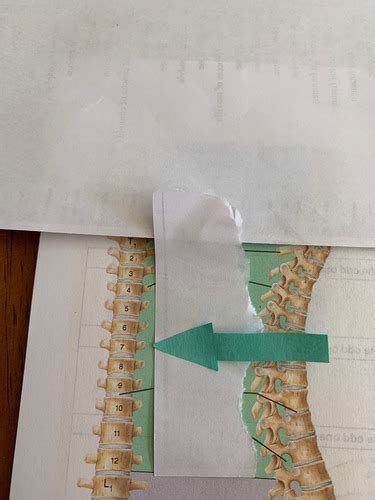 Thoracic Vertebrae Flashcards Quizlet