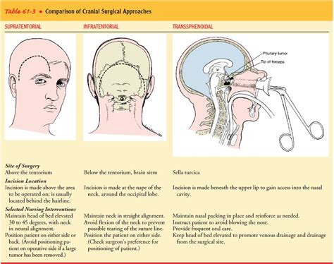 Intracranial Surgery