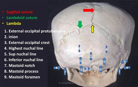Skeleton On Head Bony Features Of Norma Occipitalis 2018 Pptx