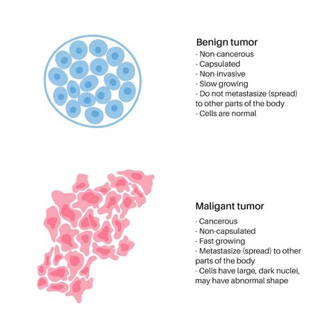 Premium Vector Vector Isolated Illustration Of Malignant And Benign