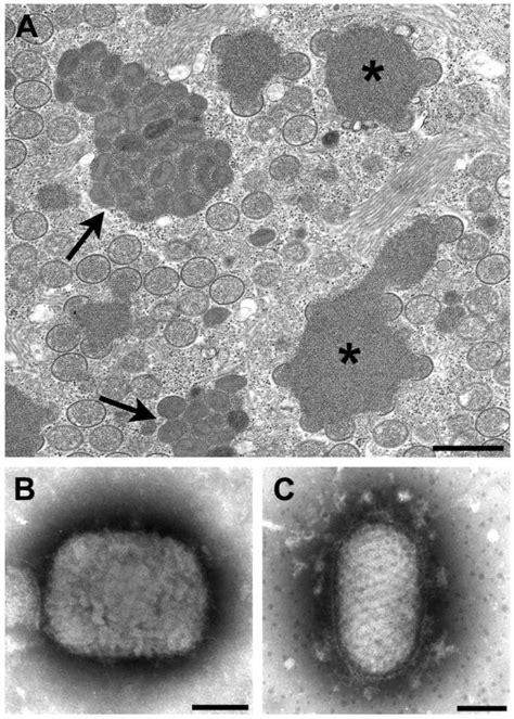 Virus Electron Micrograph