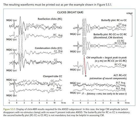Display Of Click Abr Results Required For Ansd Subprotocol Figure 5 5 1 Download Scientific