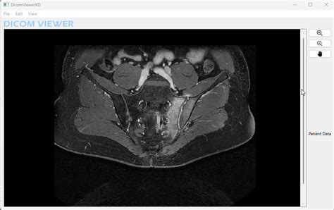 Video Brandon Gutierrez On Linkedin Simple Dicom Viewer Using Qt And