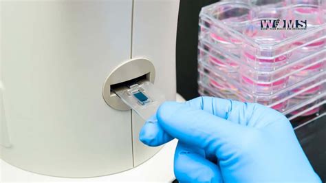 Must Have Features In Automated Cell Counters Woms