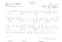 Ecg Final Object Detection Dataset By Ecgartivatic
