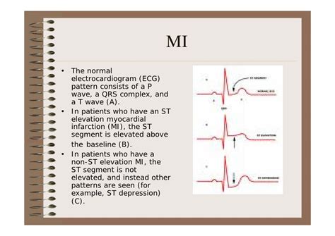 Cardiac Ecg Interpretation