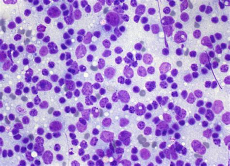 Lymph Node Eurocytology