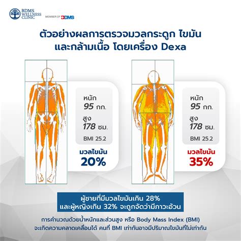 Dexa Scan Bdms Wellness Clinic