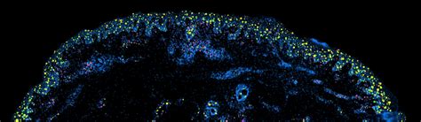 Single Cell Atlas Of The Whole Human Lung