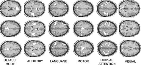 Selected Axial Slices Of The Brain Showing Rsns Detected In The Example