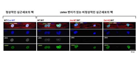 국내 연구진 심장질환 발병 원인 규명·새 치료 표적 제시네이처誌 게재