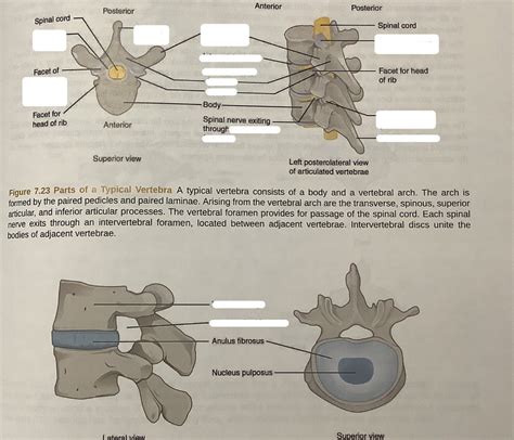 16 Typical Features Of A Vertebrae 723 724 Diagram Quizlet