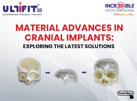 Material Advances In Cranial Implants Exploring The Latest Solutions 3dincredible
