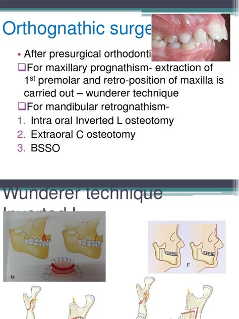 Class 3 Maloclusion Orthodontics Tooth Free 30 Day Trial Scribd
