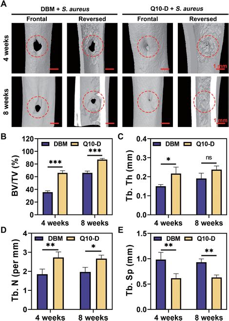 Cationized Decalcified Bone Matrix For Infected Bone Defect Treatment