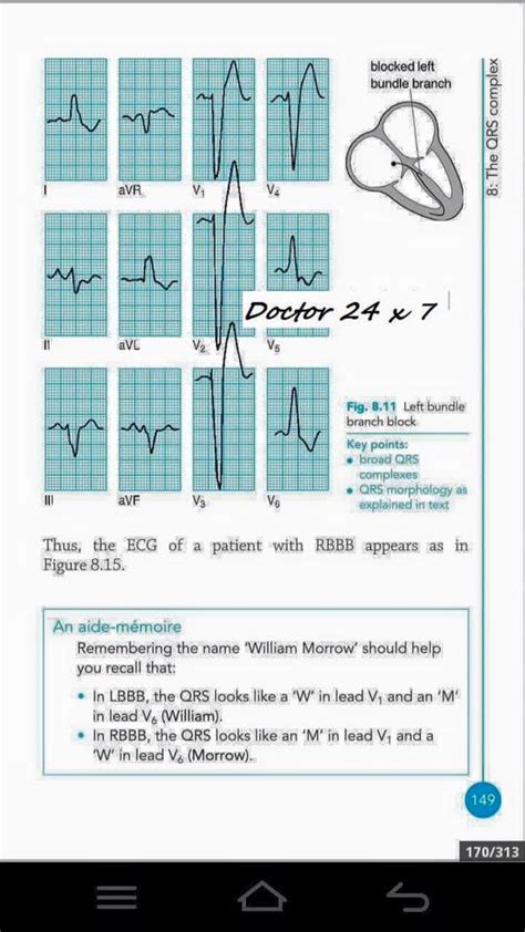 Amudu Easy Way To Learn Ecg Step By Step In A Very Easy Way
