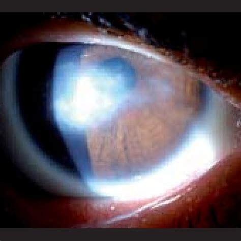 Healed Epithelial Defect Download Scientific Diagram