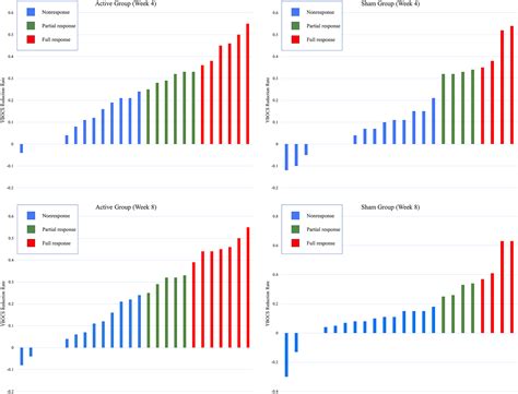 Continuous Theta Burst Stimulation Over The Bilateral Supplementary Motor Area In Obsessive