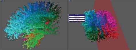 “perceptual Coloring And 2d Sketching For Segmentation Of Neural