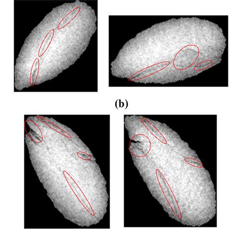 Schematic Representation Of The Efficientnet B0 Cnn Implemented For The Download Scientific