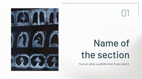 All About Radiology Google Slides PowerPoint Template