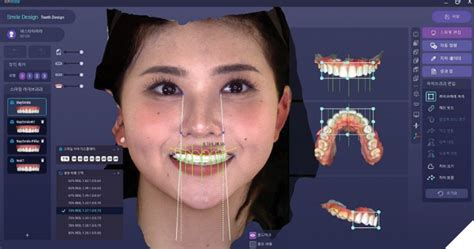 Reshaping Dental Care With Artificial Intelligence Oral Health Group