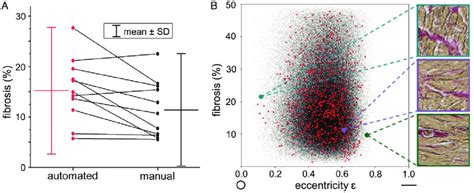 Comparison Of Automated And Manual Fibrosis Quantification In Histology Download Scientific