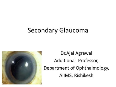 Secondary Glaucoma Final Pptx